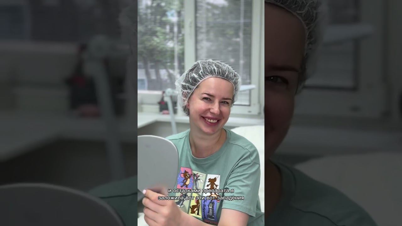 Коррекция губ Belotero Intense