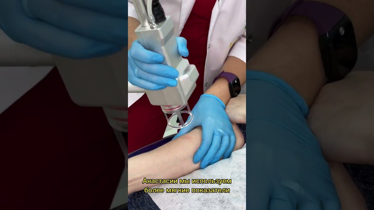 Коррекция рубца лазером