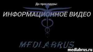 Интубация и искусственная вентиляция легких