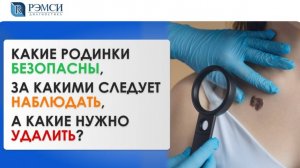 Какие родинки безопасны, за какими следует наблюдать, а какие нужно удалить?
