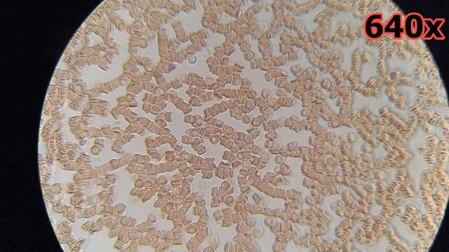Показатели Крови после ВОДОРОДной воды.