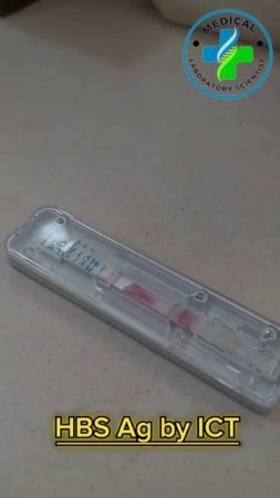 HBsAg test | Hepatitis B surface antigen | Hbs Ag serology | Hepatitis B Virus | HbsAg by ICT | Hbs