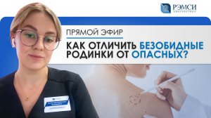 Как отличить безобидные родинки от опасных?