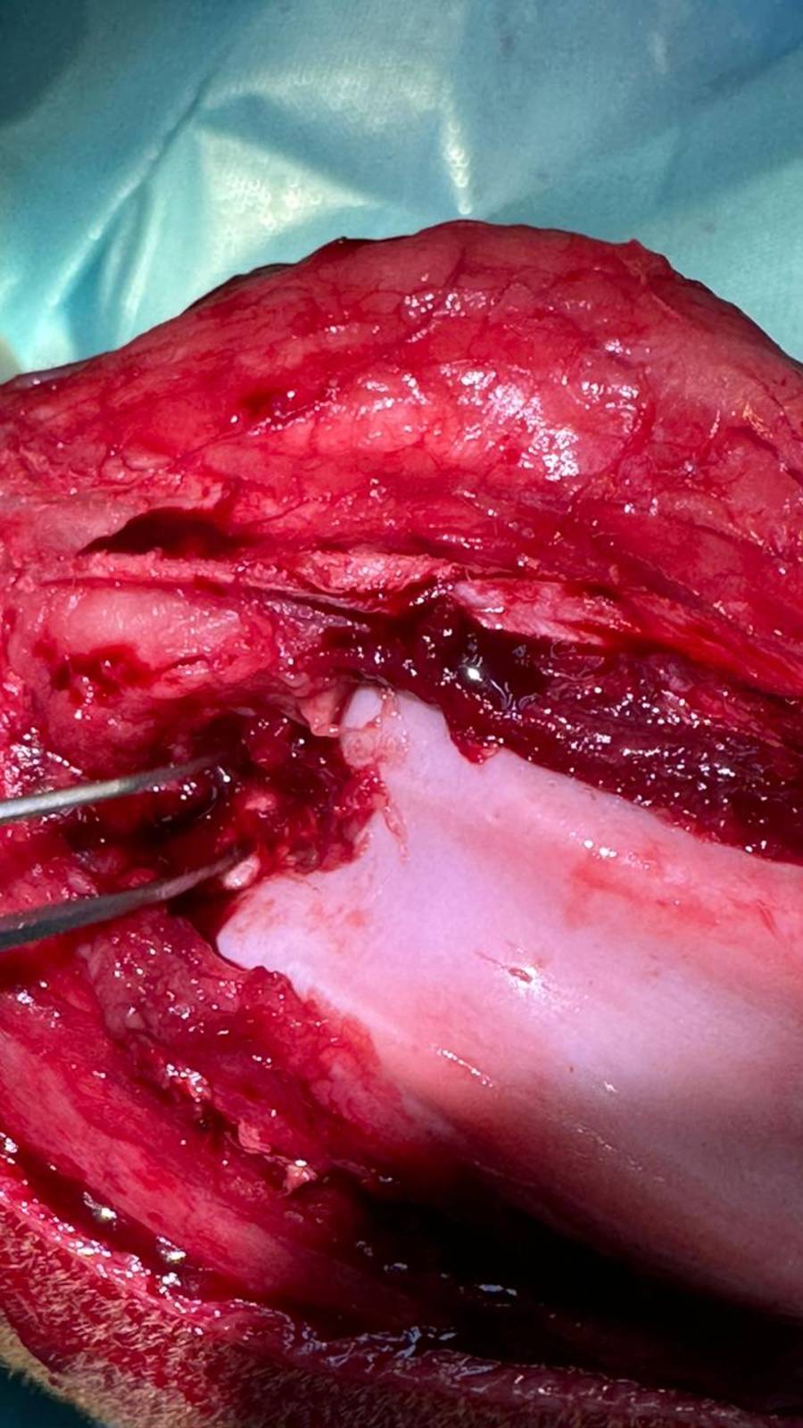 разрыв ПКС собака 43 кг Лёня  - положительный тест "выдвижного ящика"