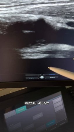 Просто покажу вам бляшку