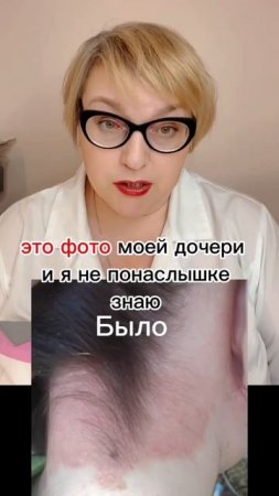 Лекарство от псориаза найдено, лечение заказ по ссылке в комментариях! #псориаз #псориазлечение