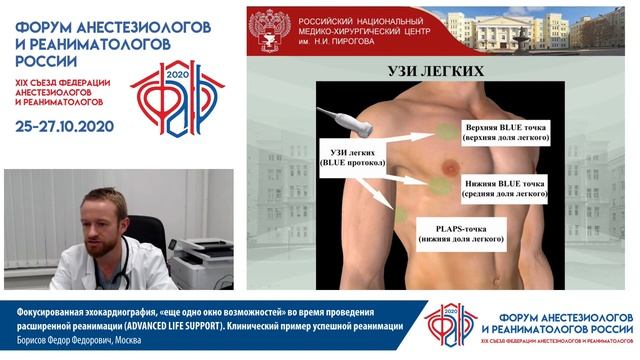 Фокусированая эхокардиография Борисов ФФ  ФАРР 2020