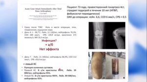 IV: Дифференциальный диагноз микрокристаллических артритов. Место и время хирургического лечения