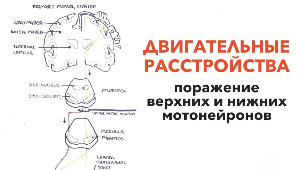 Повреждения верхних и нижних двигательных нейронов