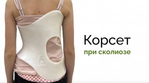 Корсет при сколиозе краткий обзор
