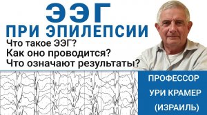 Что такое ЭЭГ? Как делают проверку и что она показывает? Отвечает профессор Ури Крамер
