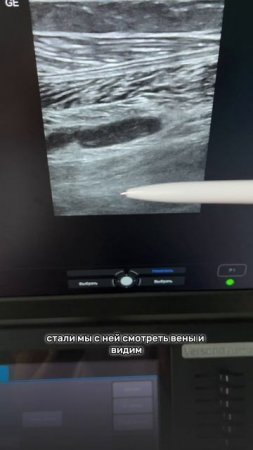 Вопрос: Почему тянуло в ноге?