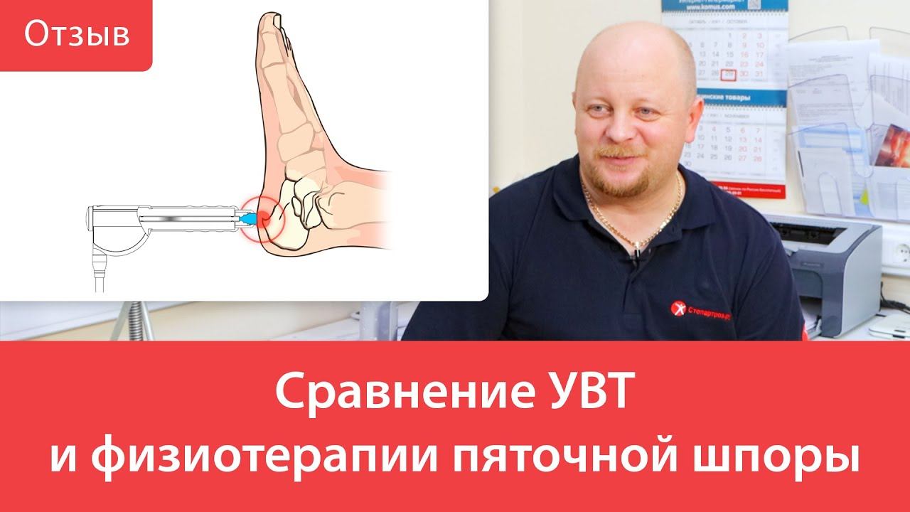 Сравнение УВТ и физиотерапии пяточной шпоры