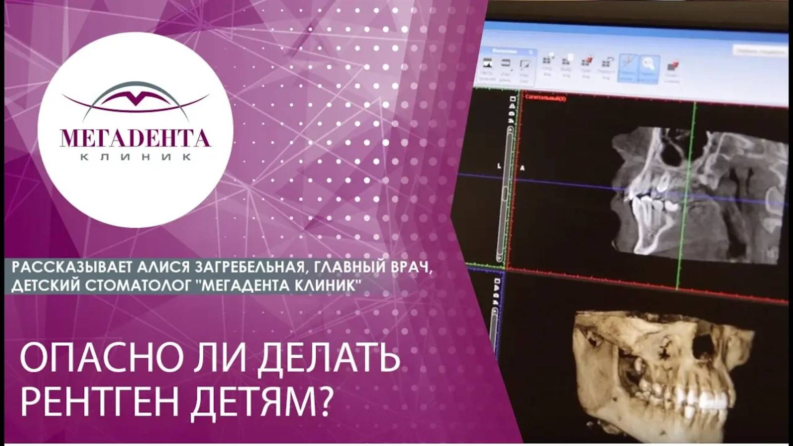 Опасно ли делать рентген детям? Рассказывает Алися Загребельная, главный врач, детский стоматолог