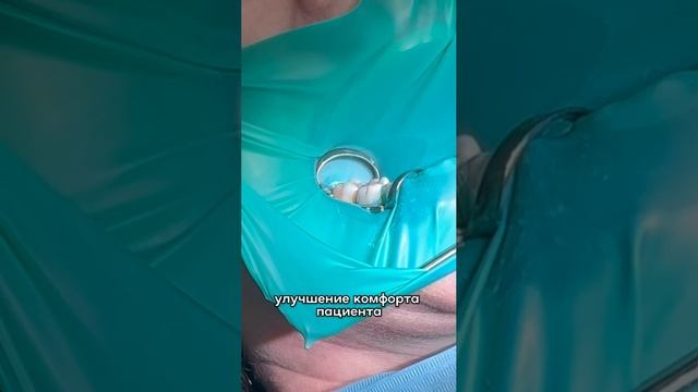 Коффердам -преимущества