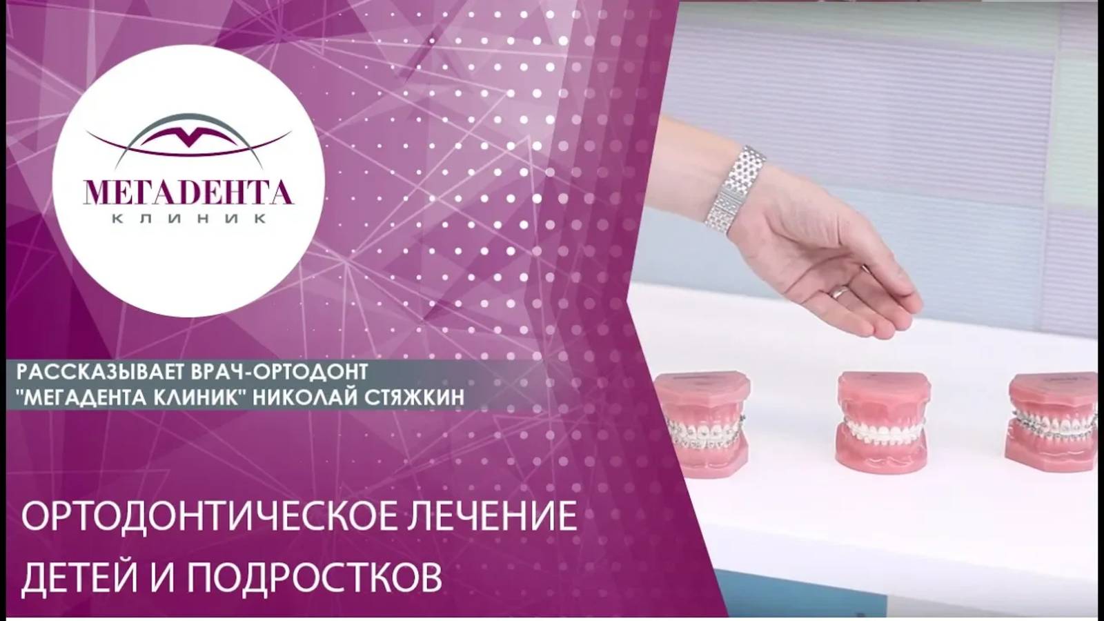 Ортодонтическое лечение детей и подростков. Рассказывает врач-ортодонт Николай Стяжкин