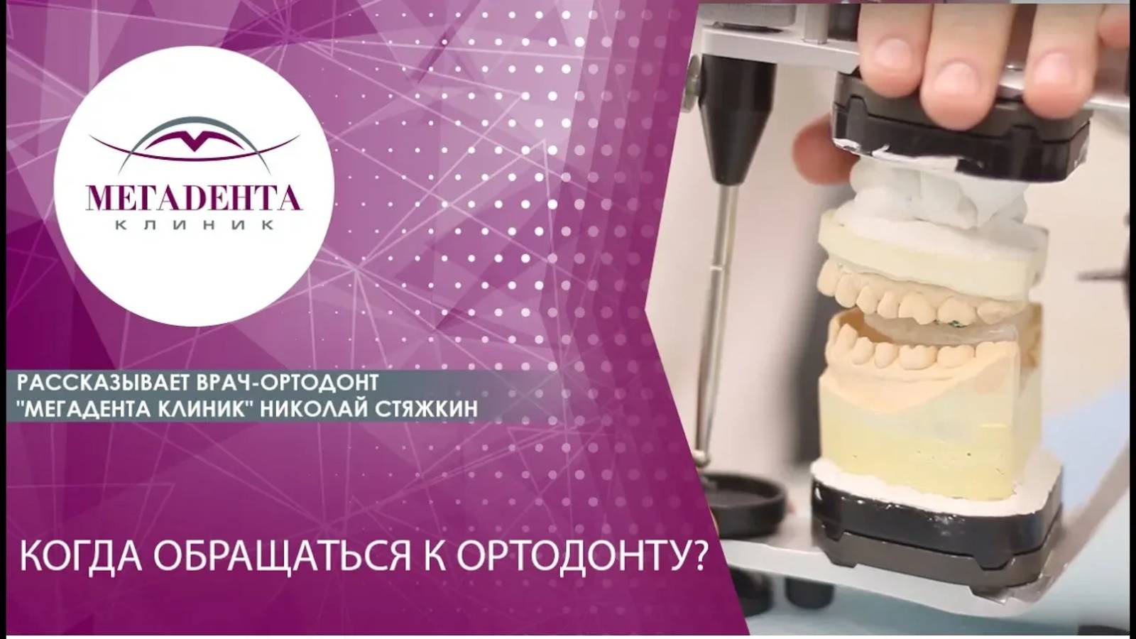 Когда обращаться к ортодонту? Рассказывает врач-ортодонт "Мегадента Клиник" Николай Стяжкин