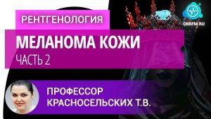 Профессор Красносельских Т.В.: Меланома кожи. Часть 2