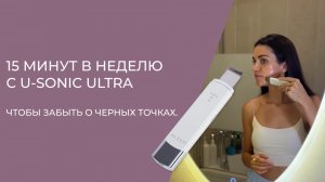 15 минут в неделю с U-Sonic Ultra, чтобы забыть о черных точках. Артикул на вб 200134913