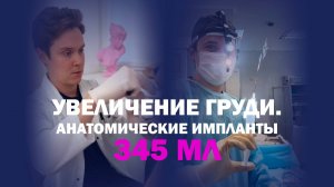 Увеличение груди анатомическими имплантами 345 мл — результат через месяц