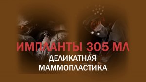 Анатомические импланты 305 мл: деликатное преображение