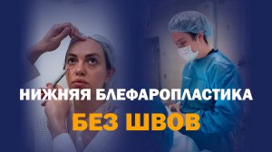 Грыжи исчезли без швов: трансконъюнктивальная блефаропластика