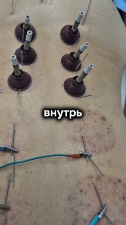 Лёгкое, приятное тепло для выших мышц! #лечение #польза #здоровье