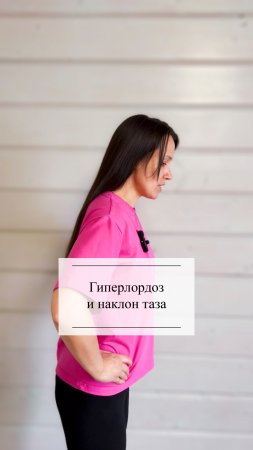 Гиперлордоз и наклон таза ☝🏻