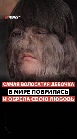 Болезнь любви не помеха. Как самая волосатая девушка в мире нашла себе пару?