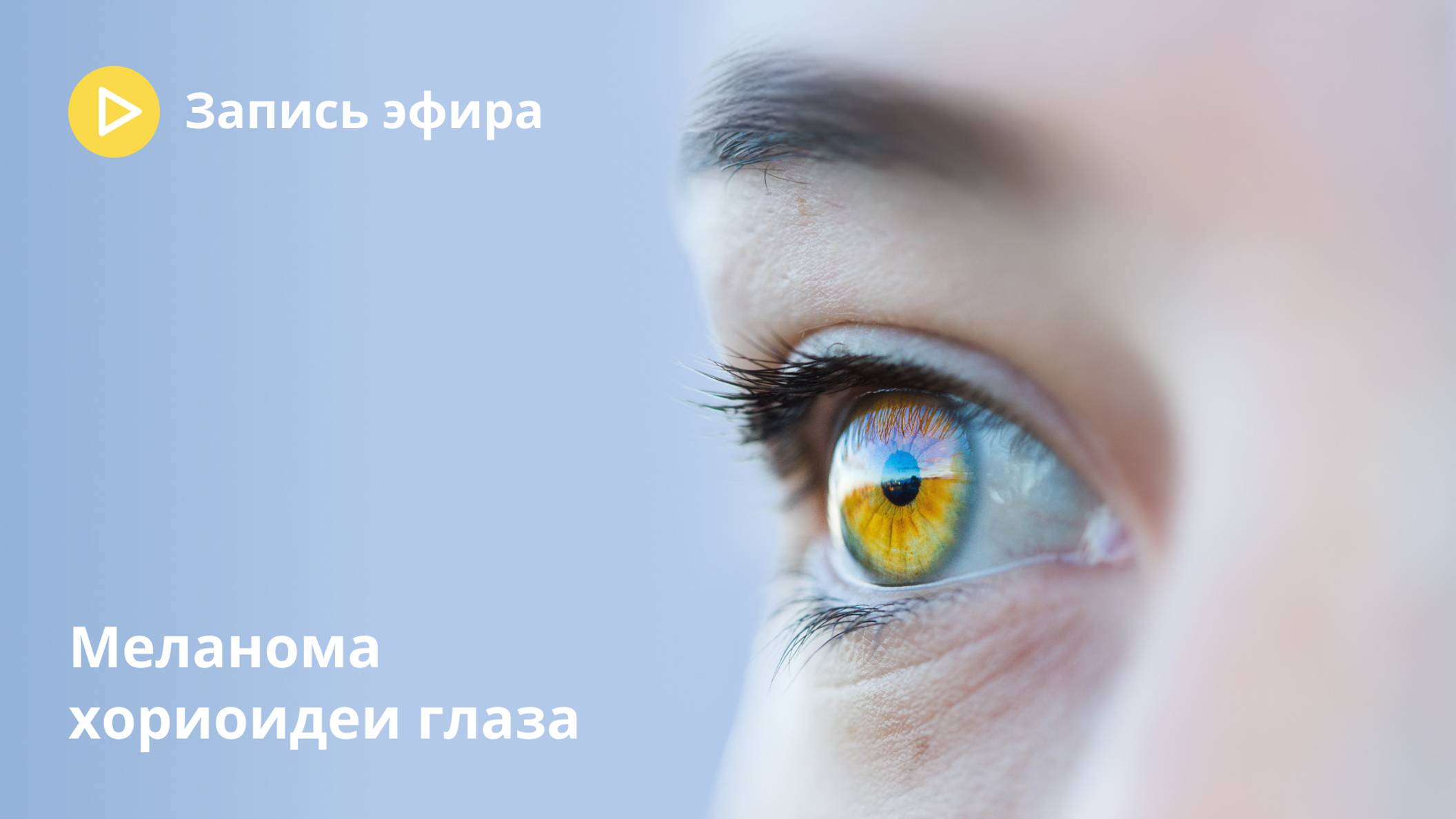 Меланома глаза