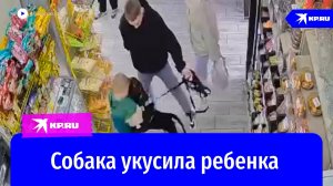 В Краснодаре собака укусила ребёнка за лицо