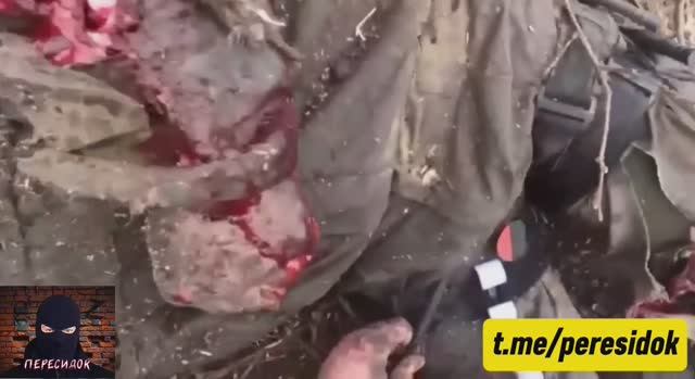 Медик ВСУ наложил турникеты на все конечности раненого