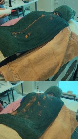 Огненный массаж в Центре Искандера Касимова! #польза #здоровье