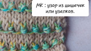 МК: узор из шишечек или узелков.
