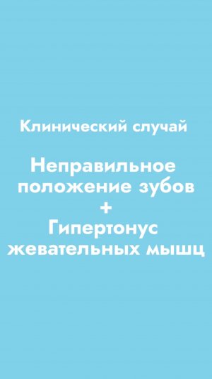 Зачем нужен ГНАТОЛОГ? Клинический случай