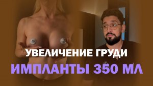 Пышная грудь и пуш-ап эффект за 50 минут: операция у доктора Мустафаева