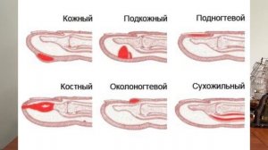 Про зравохранение, страховые компании, а также про гнойные воспалительные процессы и катушки Мишина