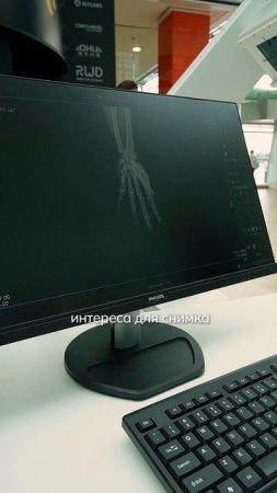 Ангиографический комплекс с функцией стационарного рентген-аппарата BizVet Dynamic для животных ч.4