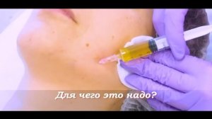 Плазмотерапия