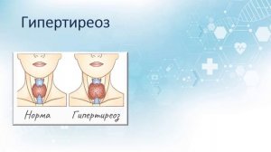 Эндокринные заболевания и их профилактика