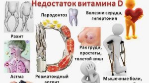 ПОЧЕМУ НАМ НЕ ХВАТАЕТ ВИТАМИНА Д