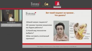 Фототермическая реконструкция тканей. Альтернатива операции пациентов с 3-4 ст. птоза. Музыка С. А.