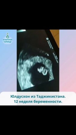 12 недель беременности