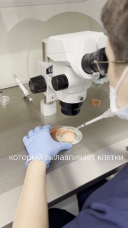 Как происходит забор яйцеклеток