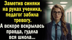 Заметив синяки на руках ученика, педагог забила тревогу. А когда правда открылась, гудела вся школа