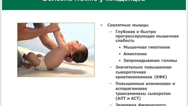 Наследственные заболевания нервной системы