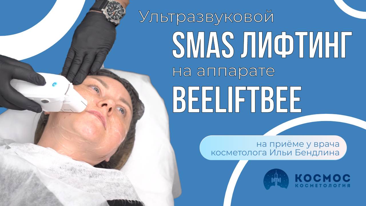 Самый безболезненный и не дорогой SMAS лифтинг