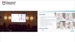 Прецедент международного Tumor Board для одного пациента. Швед Нина