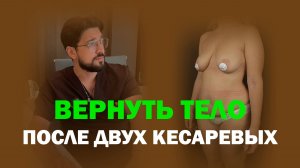 Комплексное преображение после двух родов: живот и грудь — как новые