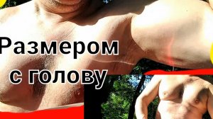 Мышцы рук как ноги несмотря на хворь и травмы.